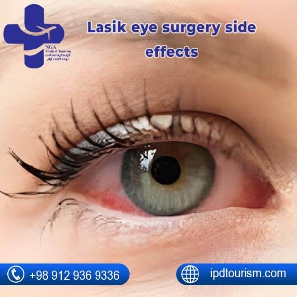 lasik Eye Surgery in Iran | Medical Tour in Iran