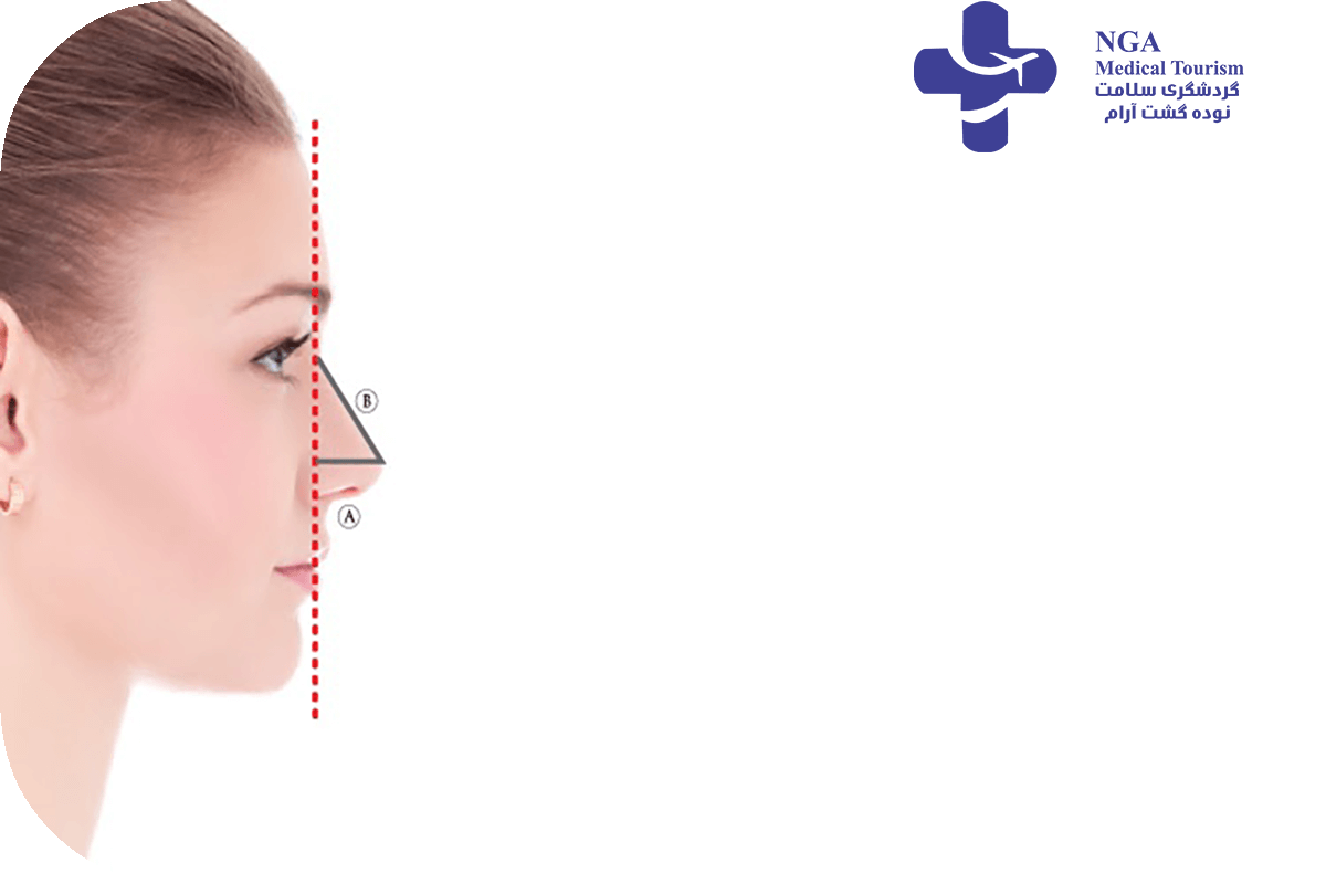 What is the best nose shape? All About Nose Shapes | Medical Tour in Iran